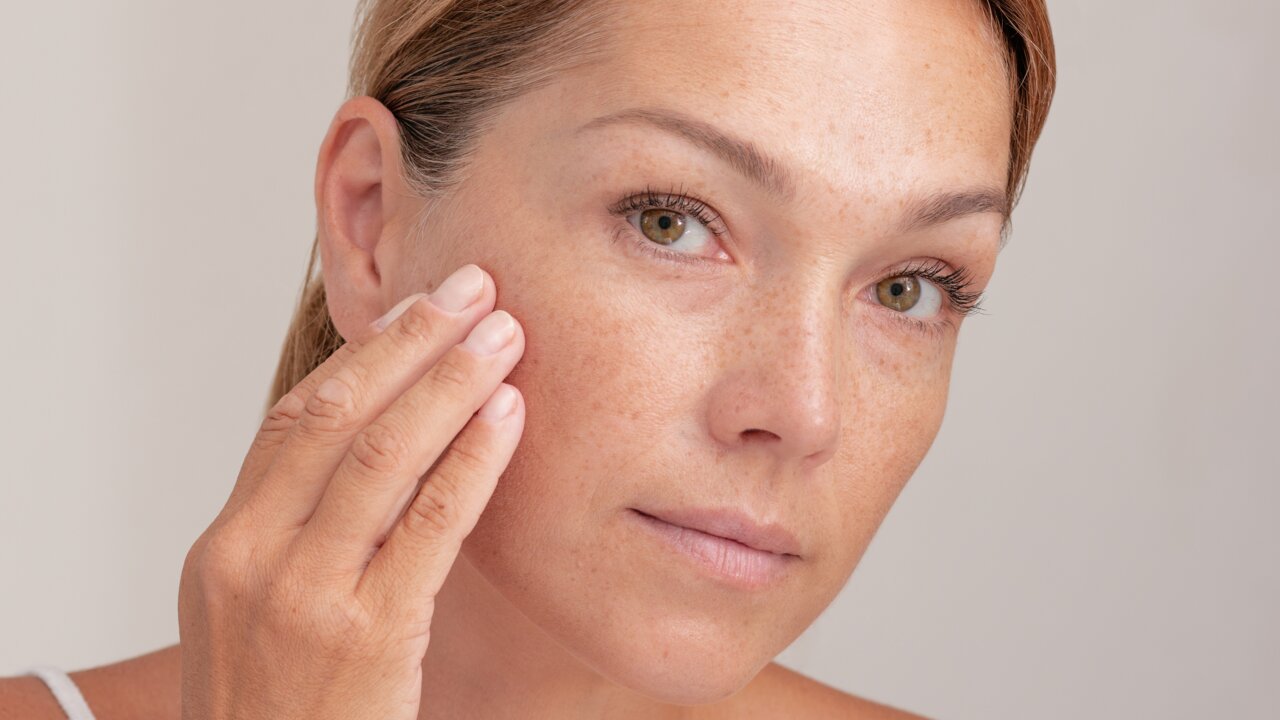 Pigmentflecken entfernen: Wirkstoffe und Methoden im Check